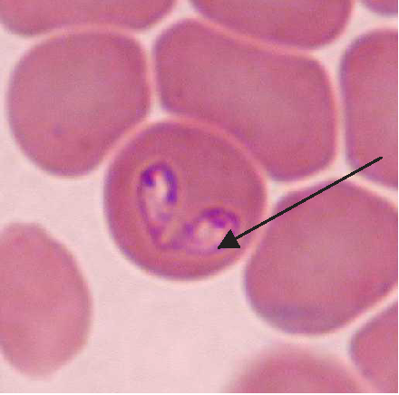 Canine babesiosis – Bioguard