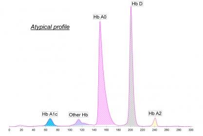 Canine HbA1c – Bioguard